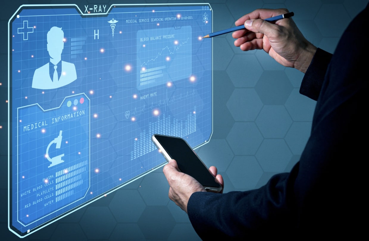 Beyond Implementation: How to choose the right Support model? - HRchitect